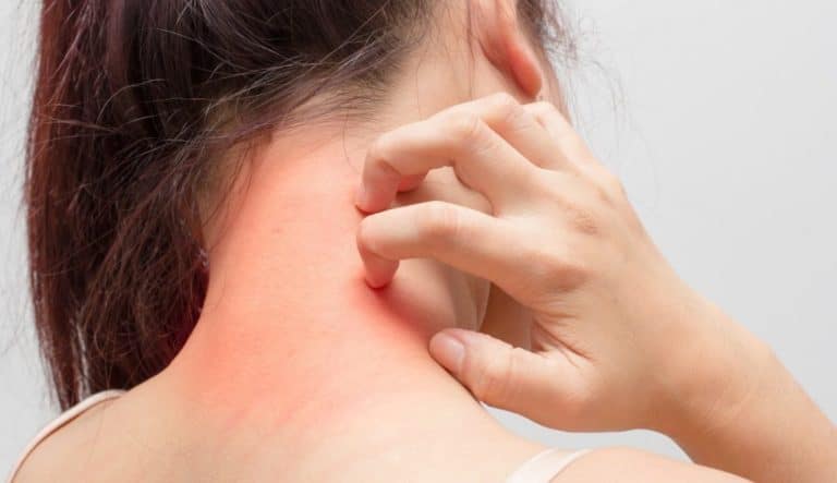 DEET Mückenschutz: alles über den Wirkstoff | Moskitofrei